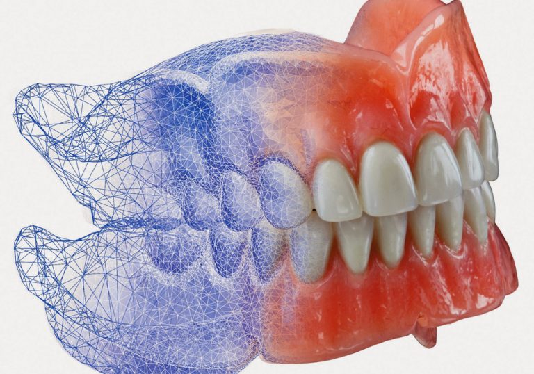 Digital and smart teeth - TGMED